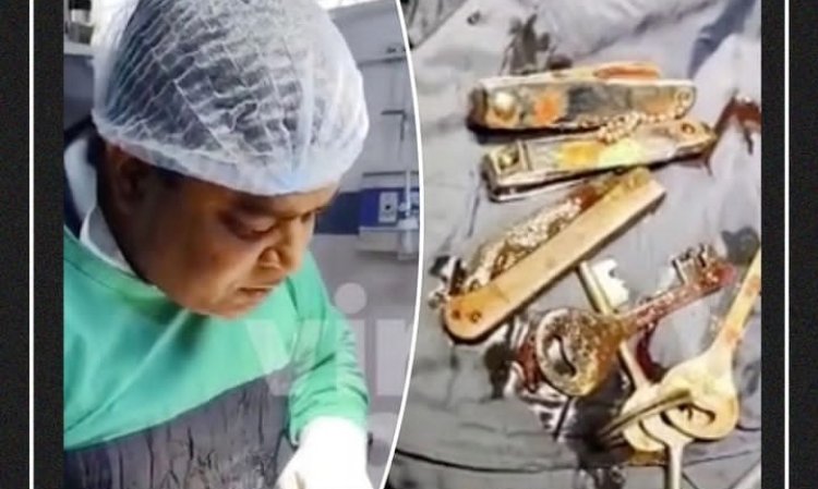 Yakuwe imisumari n'ifunguzo mu nda - Thechoicelive Entertainment Daily ...